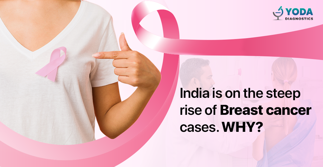 Best diagnostic centers in Hyderabad | Yoda diagnostics centre